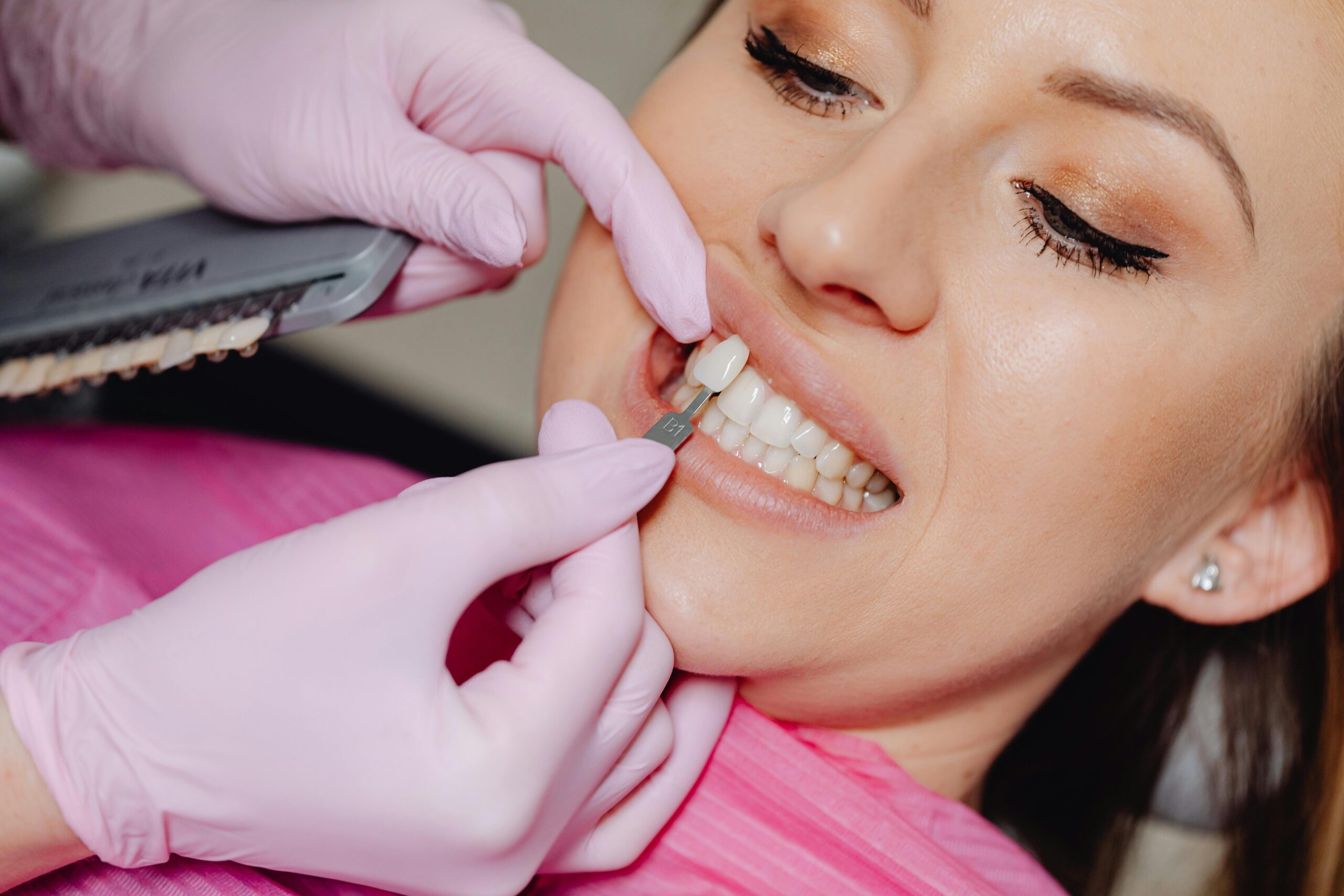 Denti in Albania Recensioni - FiDent Care – Clinica Specializzata in ...